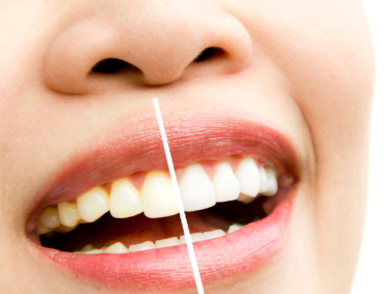 Top Rated Best Dentist in Margao, Goa - Smile Craft Goa